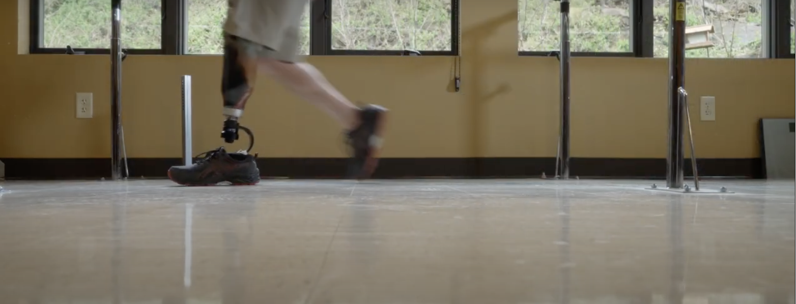 Miller Prosthetics wins VA contracts with support from Ohio APEX ...